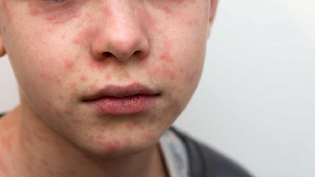 A cosa serve lo zetia? - Torrinomedica